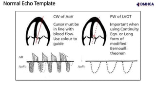 Compiling a report.pptx