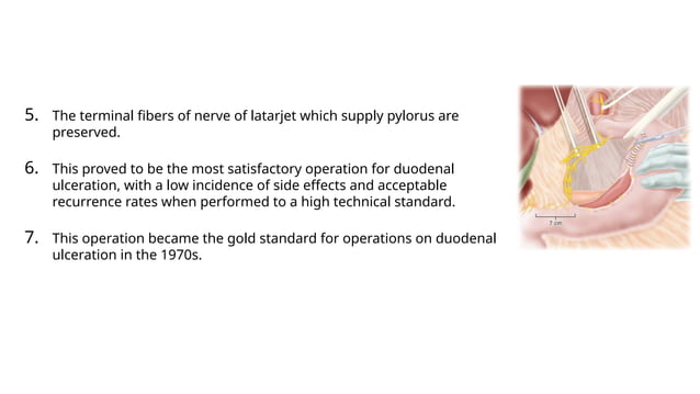 Complication Of Peptic Ulcer Disease Ppt