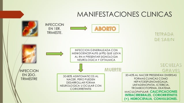 Complejo de torch por Carlos M. Montaño Pérez