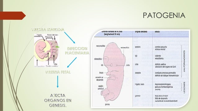 Complejo de torch por Carlos M. Montaño Pérez