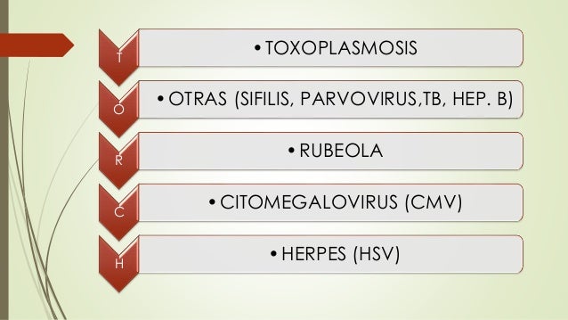 Complejo de torch por Carlos M. Montaño Pérez