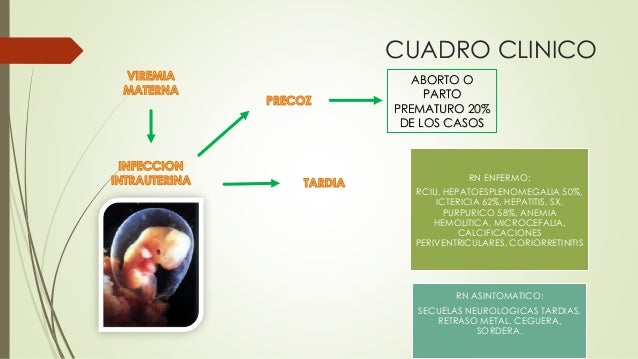 Complejo de torch por Carlos M. Montaño Pérez
