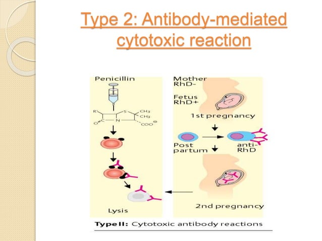 Complement and hypersensitivity | PPT