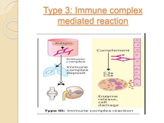 Complement and hypersensitivity | PPT