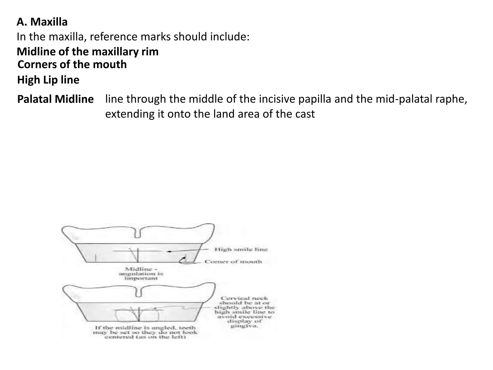 Complet dentures trail denture | PPTX
