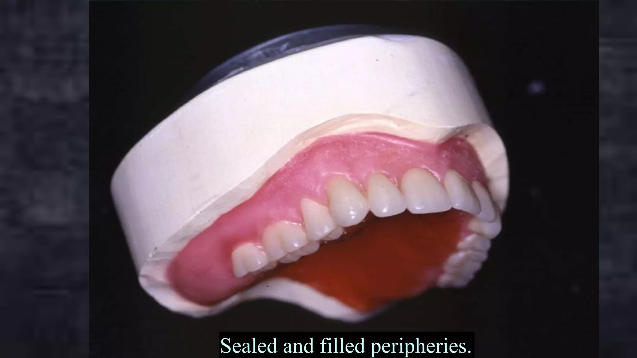 Complete denture processing & errors | PDF