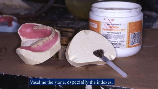 Complete denture processing & errors | PDF