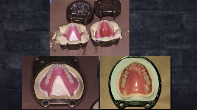 Complete denture processing & errors | PDF