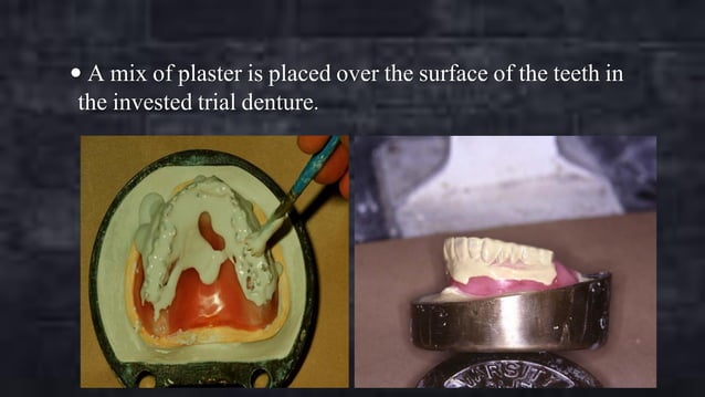 Complete denture processing & errors | PDF