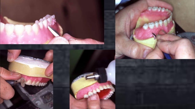 Complete denture processing & errors | PDF