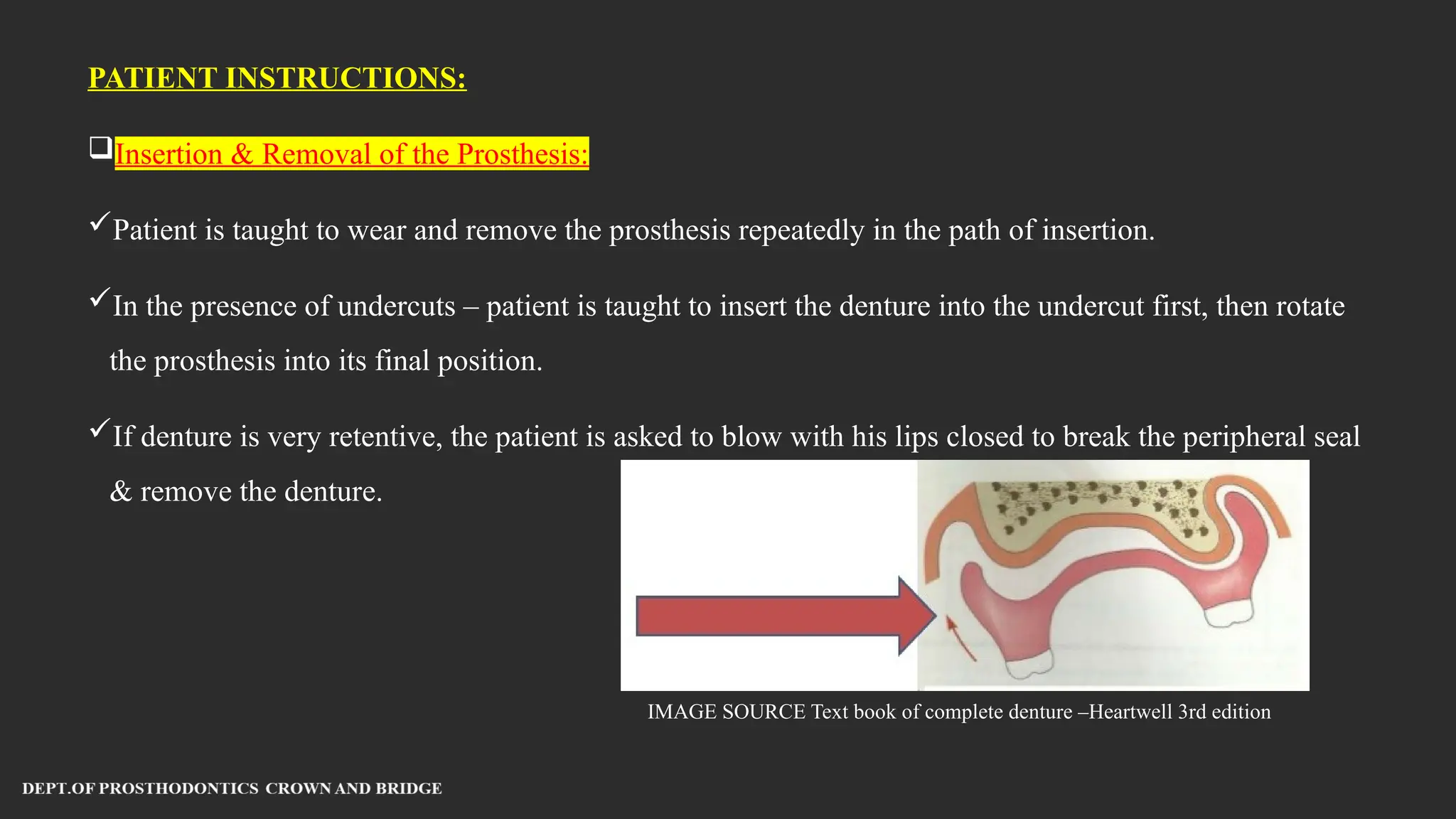 Complete-Denture-Insertion.pptxszdfxghjkl | PPTX