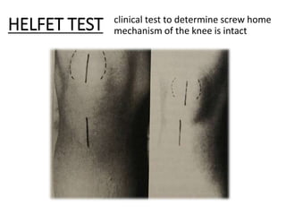 biomechanic of knee joint | PPTX