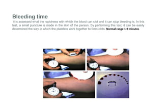 complete blood count.ppt