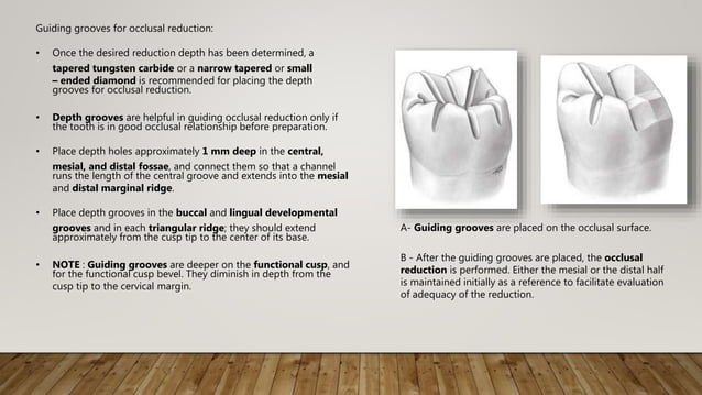 Complete cast crown | PPTX | Oral care | Personal Care