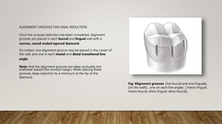 Complete cast crown | PPTX