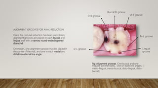 Complete cast crown | PPTX
