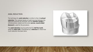 Complete cast crown | PPTX