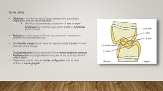 Complete cast crown | PPTX