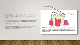 Complete cast crown | PPTX