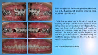 Complete clinical orthodontics by mahadia saad ALLAFY | PPT