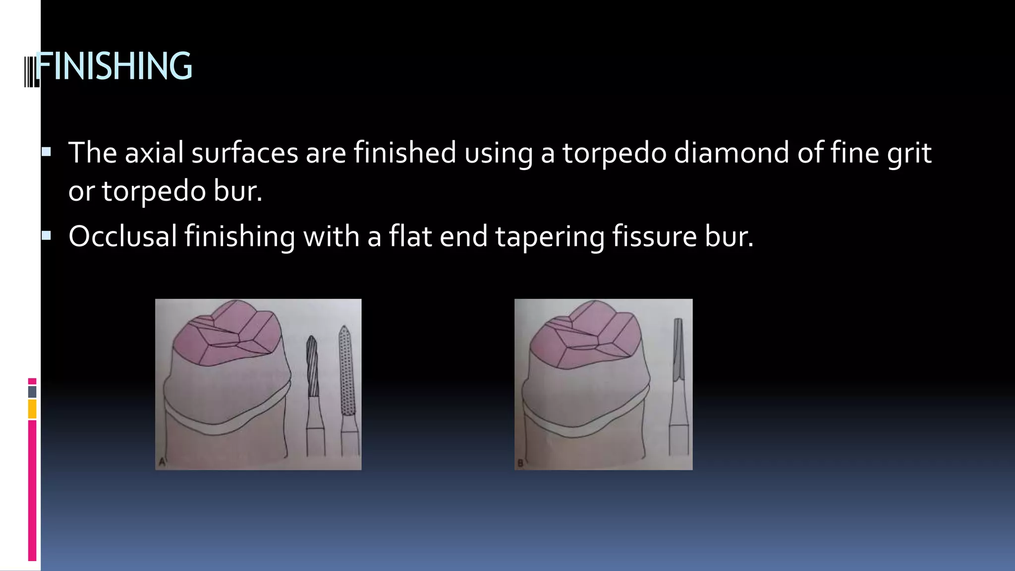 Tooth Preparation for full veneer crown | PPTX