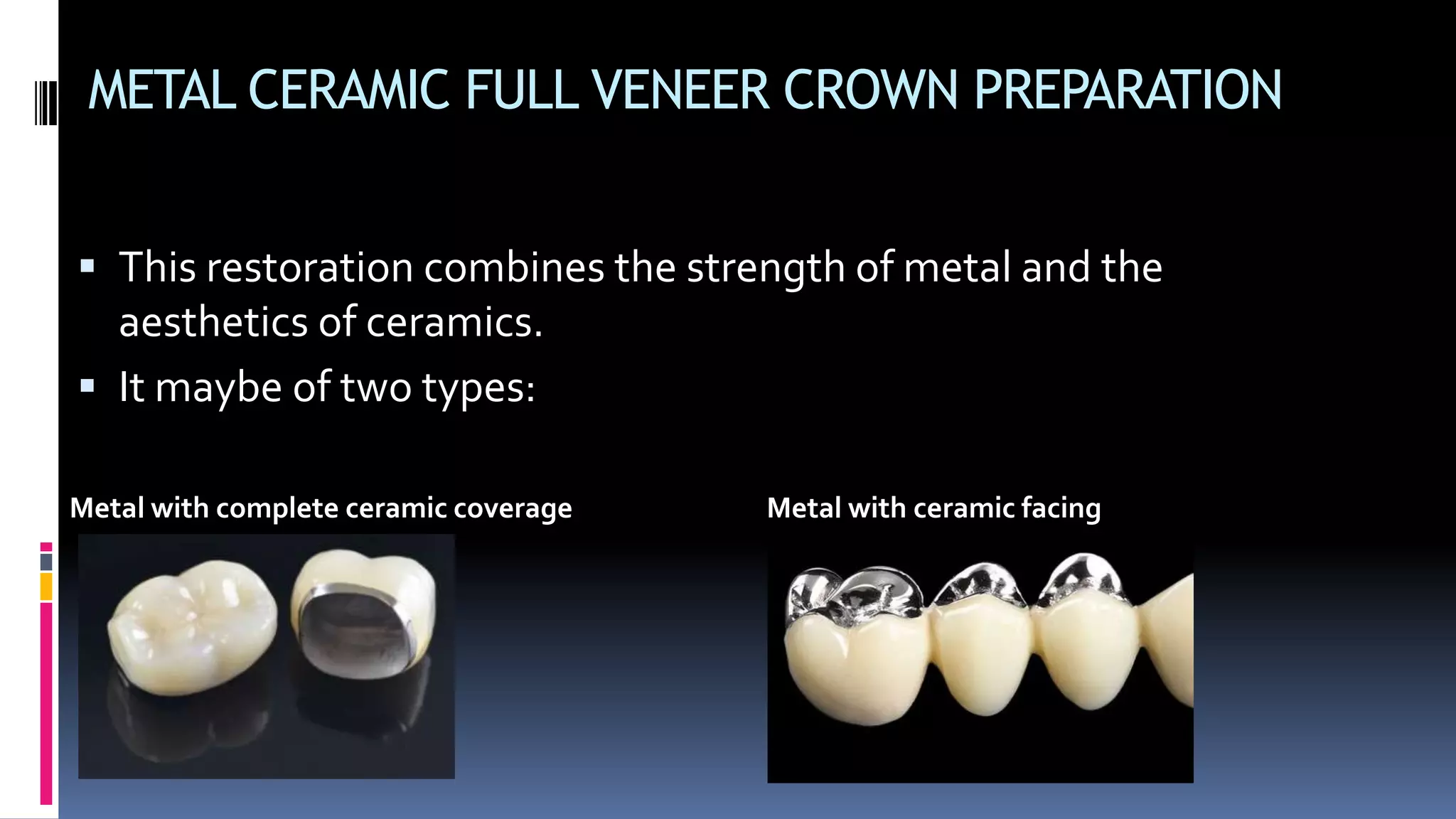 Tooth Preparation for full veneer crown | PPTX