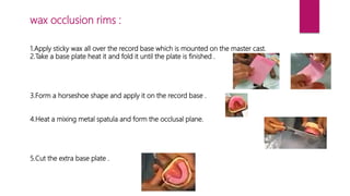 Complete dent | PPTX