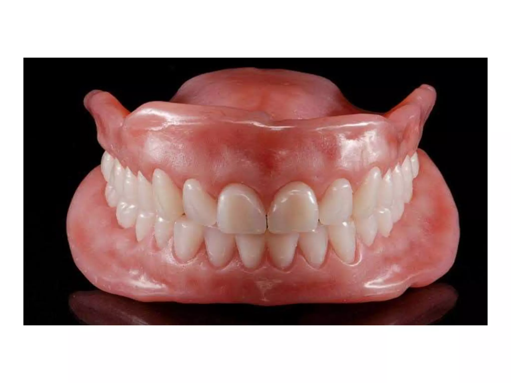 Complete denture | PPTX