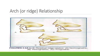 CompleteDenture.pdf | Free Download