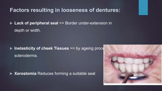 Complete denture complaints | PPTX