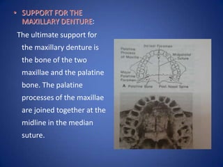 Complete Denture | PPTX