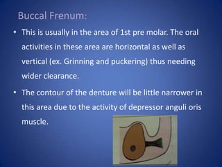 Complete Denture | PPT