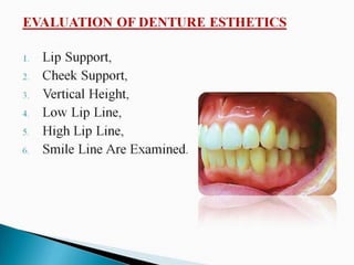Complete denture instructions | PPTX