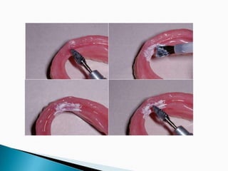 Complete denture instructions | PPTX