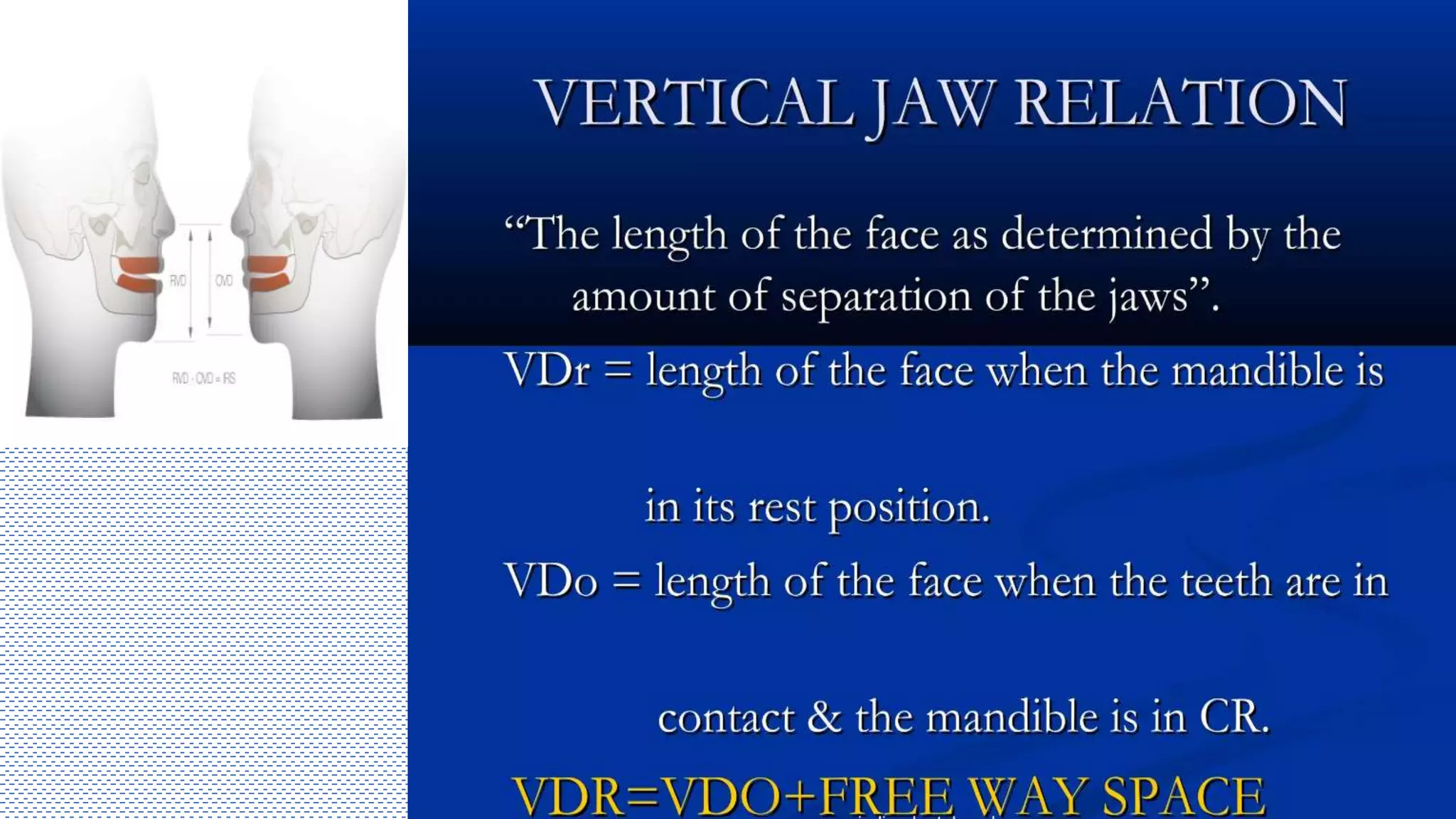 Complete Denture Jaw Relation Record.pptx
