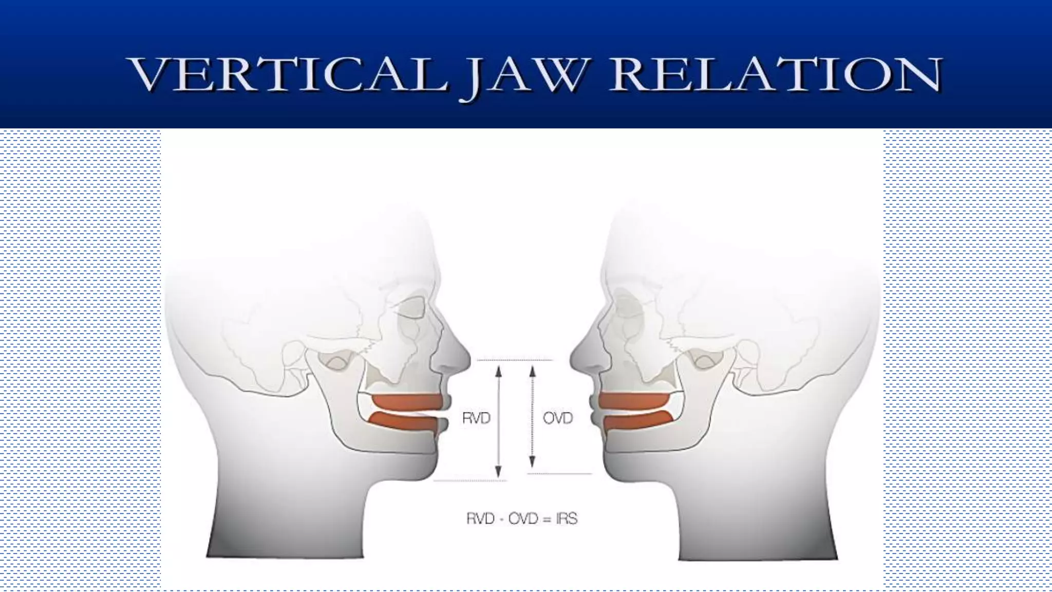 Complete Denture Jaw Relation Record.pptx