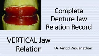 Complete Denture Jaw Relation Record.pptx