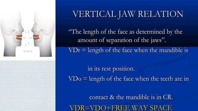 Complete Denture Jaw Relation Record.pptx