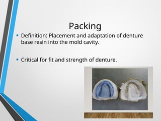 Complete_Denture_Lab_Steps_Presentation_With_Images.pptx