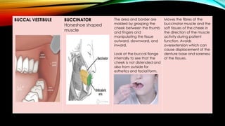 Complete Denture Musculature - Prosthodontics.pptx