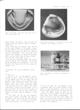 Complete denture prosthetics | PDF