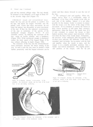 Complete denture prosthetics | PDF