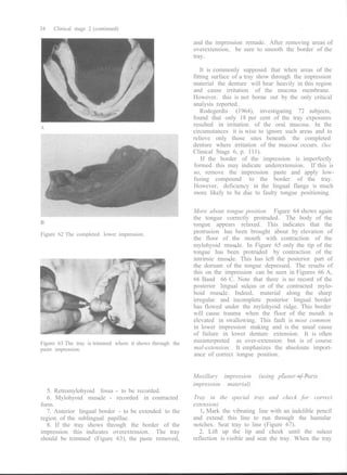 Complete denture prosthetics | PDF