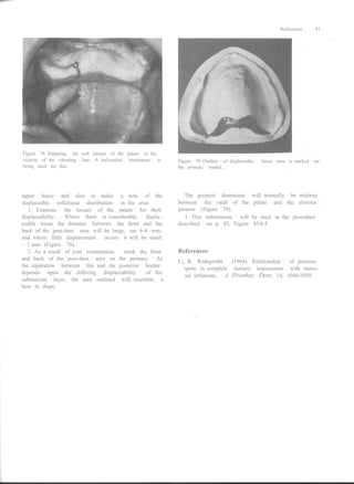 Complete denture prosthetics | PDF