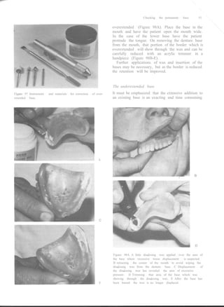 Complete denture prosthetics | PDF