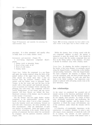Complete denture prosthetics | PDF