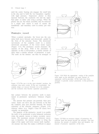 Complete denture prosthetics | PDF