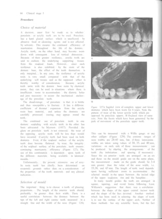 Complete denture prosthetics | PDF