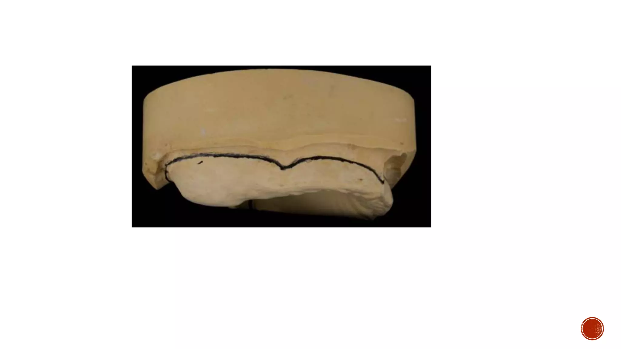 COMPLETE DENTURE PROSTHO.pptx