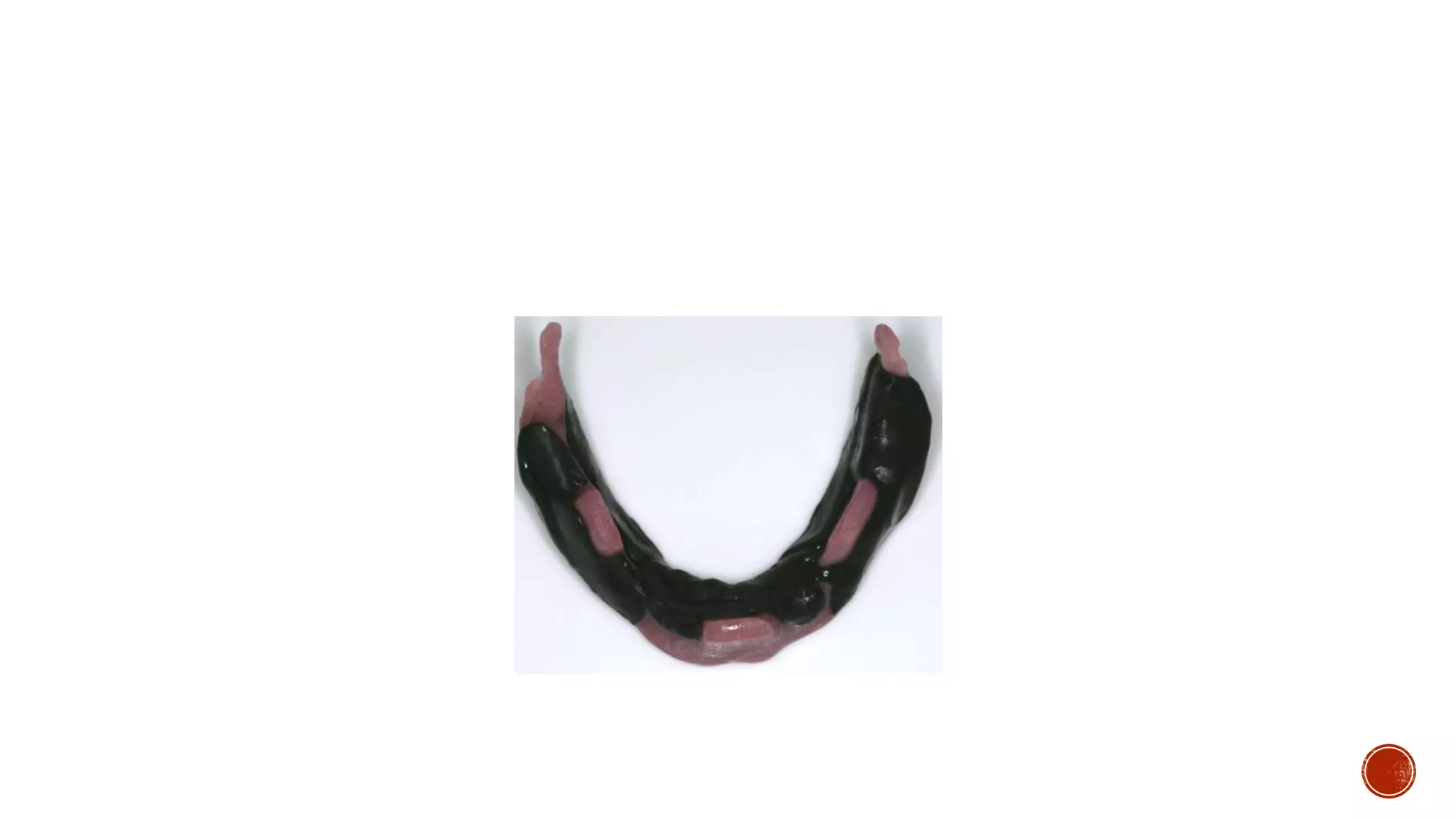 COMPLETE DENTURE PROSTHO.pptx